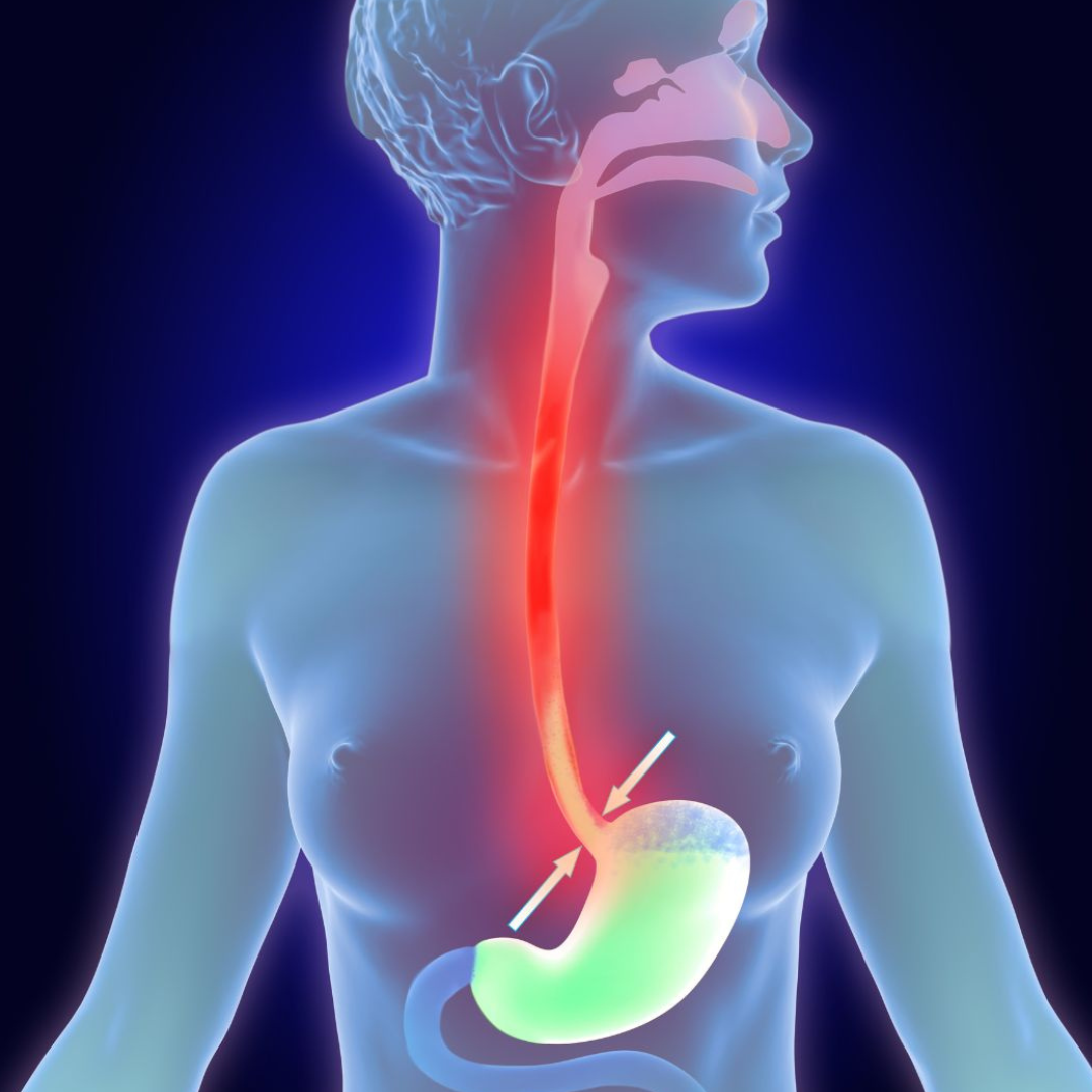 Acidity and Symptoms